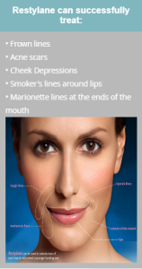 Restylane® - Minars Dermatology